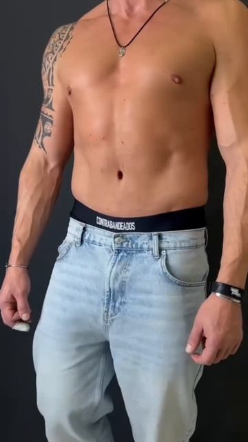 #мужская_липоабдоминопластика: результат через год