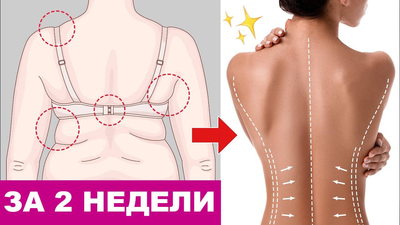 Как избавиться от валиков и складок на спине под бюстгальтером