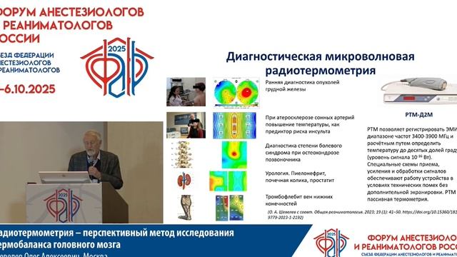 Радиотермометрия —метод исслед темпратуры мозга Шевелев О.А. 2025