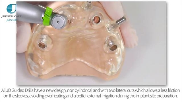 Навигационный хирургичсекий набор JD Guided Surgery Kit. Как это работает