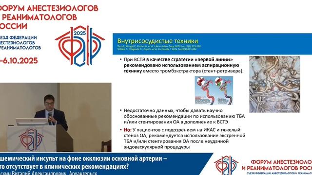 Ишемич инсульт при окклюзии основн артерии Саскин В.А. 2025