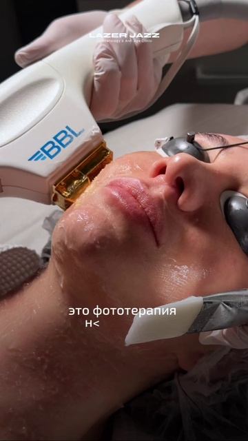 ФОТОТЕРАПИЯ BBL — это процедура, которая возвращает коже сияние.