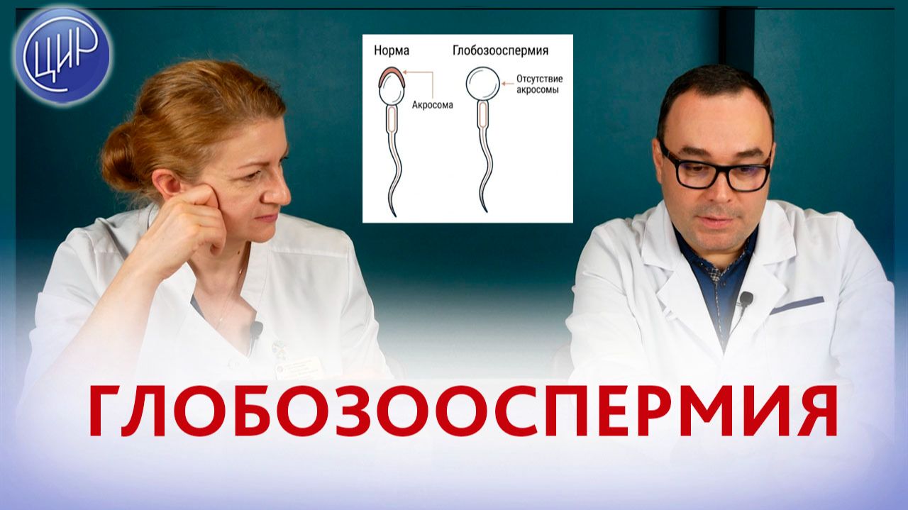 Глобозооспермия, бесплодие, невынашивание и электронная микроскопия сперматозоида.