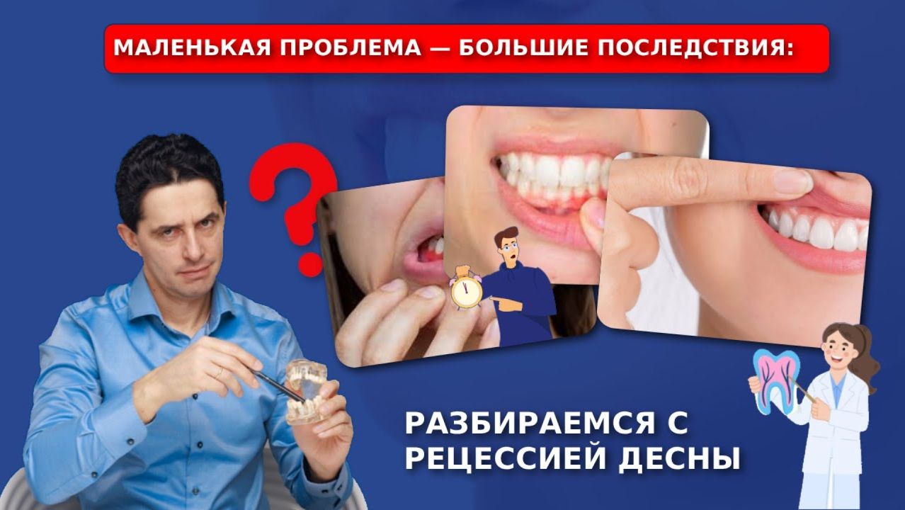 Десна под угрозой: что такое рецессия?