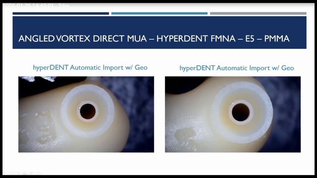 Установка абатментов с помощью винтов VORTEX