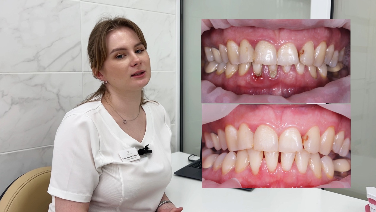 Новый видео разбор клинического случая 🔥