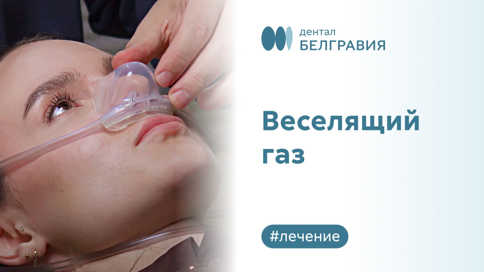 🦷 Веселящий газ