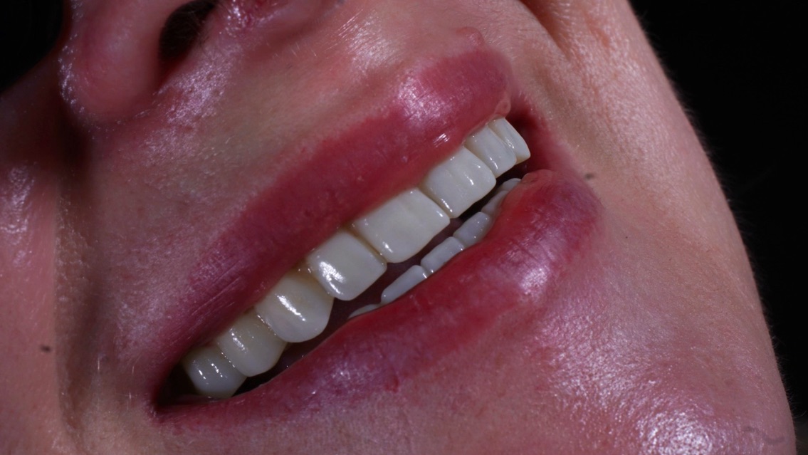 Кейс тотального восстановления 🤍