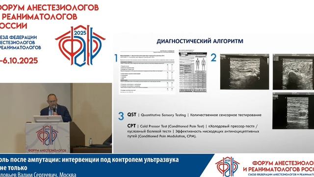 Боль после ампутации интервенции под УЗИ Соловьев В.С. 2025