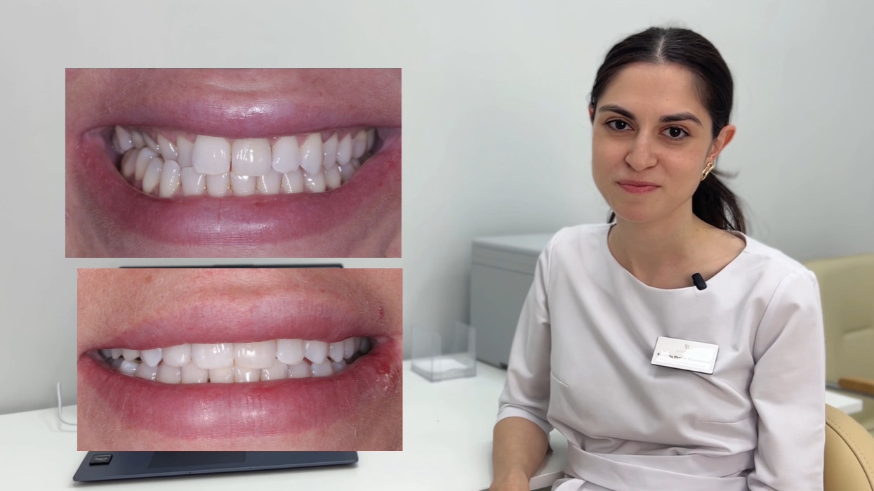 Сегодня мы рады поделиться одним из наших успехов | ОРТОДОНТИЯ