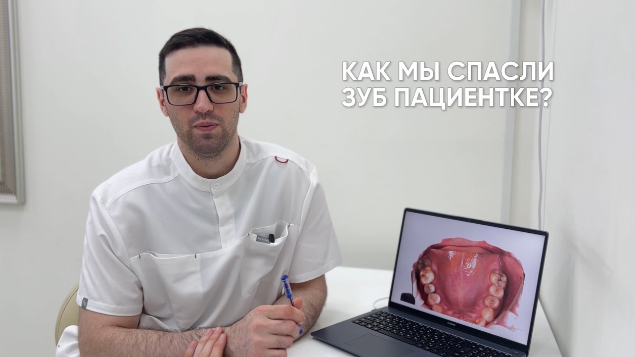 Как мы сохранили два зуба? Подробный разбор в новом видео 🔥