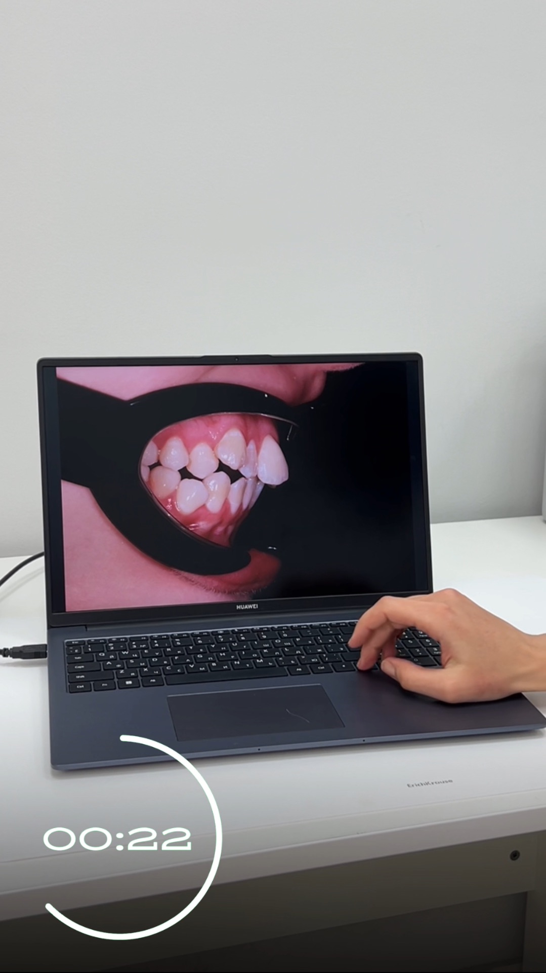 Разбор за 60 секунд - да, мы умеем быстро