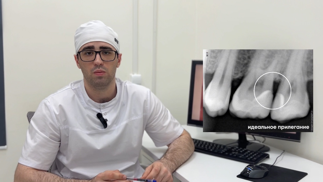 Почему врач-стоматолог-терапевт не поставил пломбу? И что такое накладки на зубы?