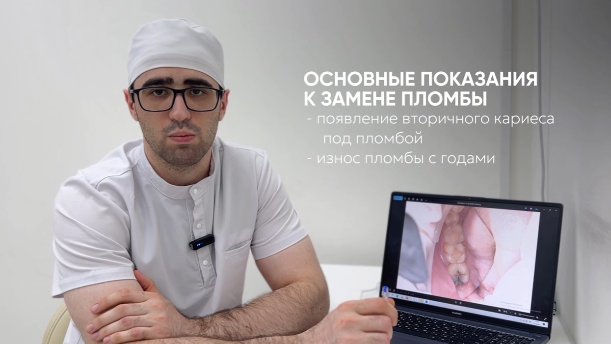 Когда пора на замену пломбы?🦷
