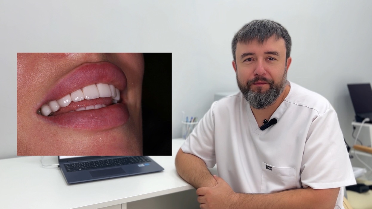 Комплексное лечение с вишенкой - ортопедией 😍