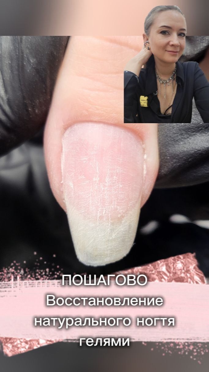 ПОШАГОВО ремонт и восстановление натурального ногтя. Hohtar