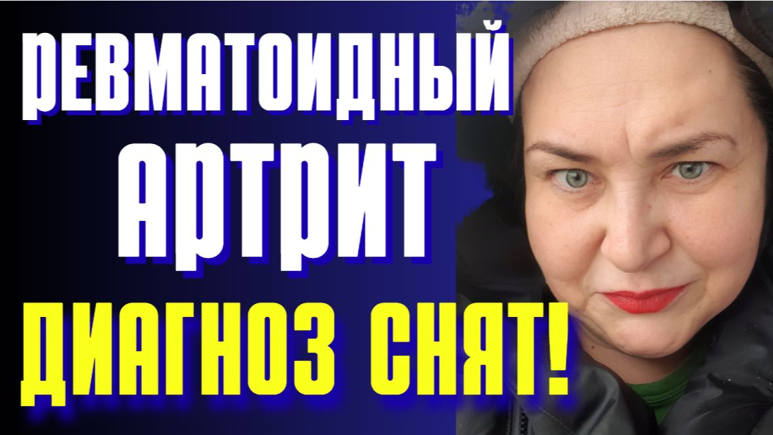 День в БЕЛГРАДЕ/РЕВМАТОЛОГ и настоящая ПЛЕСКАВИЦА