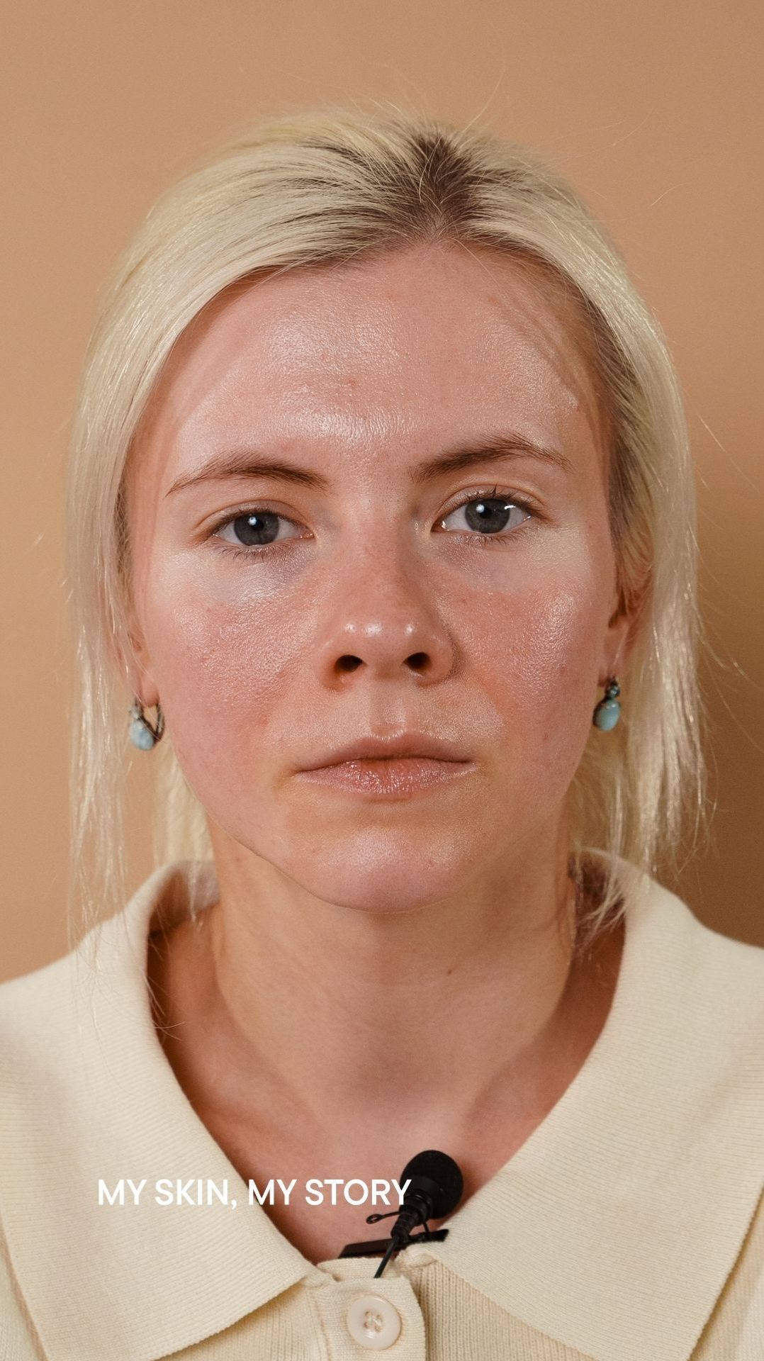 BABOR_MY SKIN, MY STORY: от сухости и покраснений к комфорту кожи