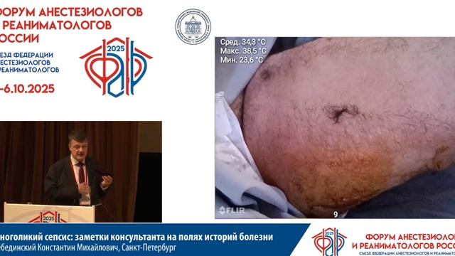 Многоликий сепсис заметки консультанта Лебединский К.М. 2025