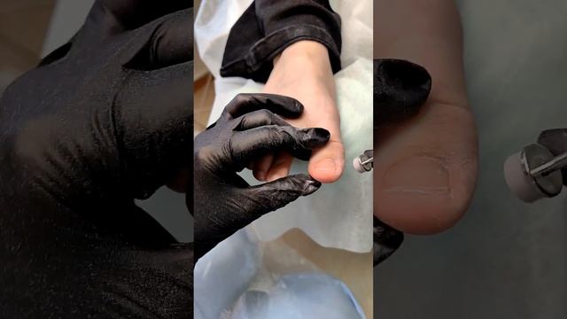 ПОДРОСТОК В КАБИНЕТЕ ПЕДИКЮРА: КАК РАБОТАТЬ БЕЗОПАСНО И ПРОФЕССИОНАЛЬНО