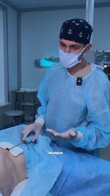 #VASER_липосакция: как мы делаем красивые рельефные животы