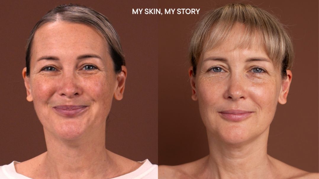 BABOR_MY SKIN, MY STORY: Очень сухая кожа и тусклый тон после 45