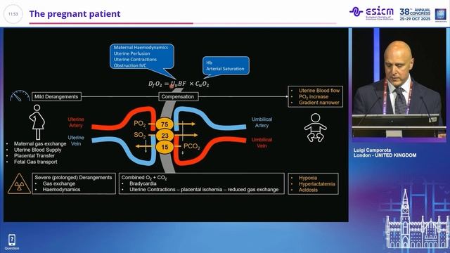 The pregnant patient MV Luigi Camporota