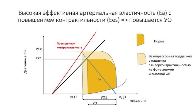 Сердечный выброс и ударный объем (л3) Анастасия Юсупова