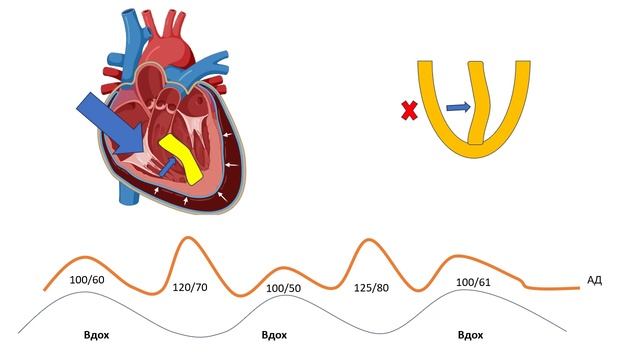 Сердечно-легочные взаимодействия (л4)  Анастасия Юсупова
