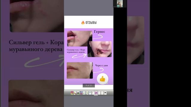 Кора муравьиного дерева с мате/селеном. Имунная система