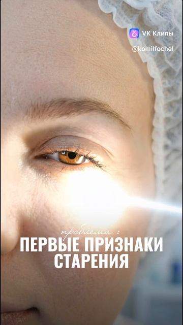 Пигмент, сосуды, омоложение: 1 процедура - 3 эффекта