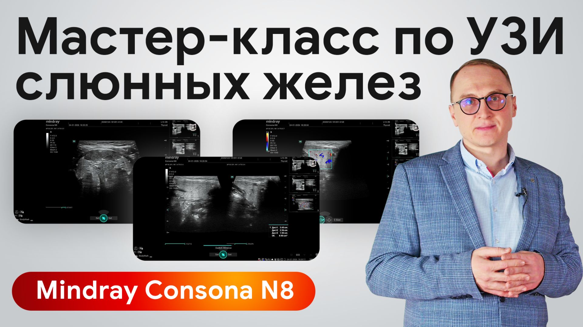 УЗИ слюнных желез в практике врача УЗД: мастер-класс на Mindray Consona N8