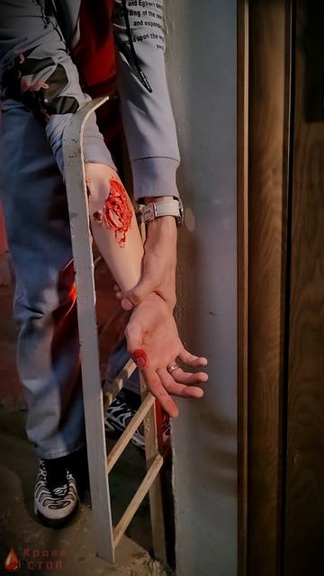 Носимое имитационное ранение “Открытый перелом плечевой кости руки” СурвМед ФальшРана мод.Rezin