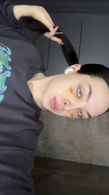 Мешки под глазами — не всегда отёки 🙅♀️