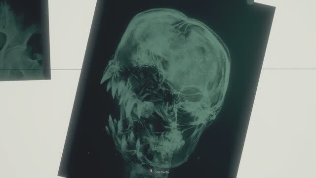 RESIDENT EVIL 4 (Remake)  №6 РЕГЕНЕРАДОР