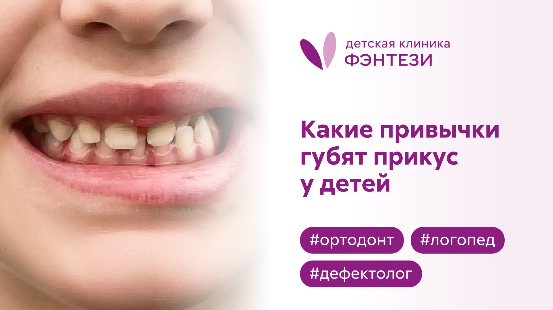 Какие привычки губят прикус у детей?