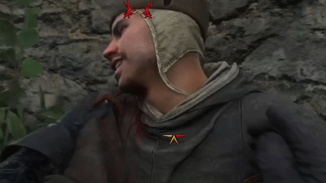 Индро стоматолог [Kingdom Come Deliverance 2]#35-1