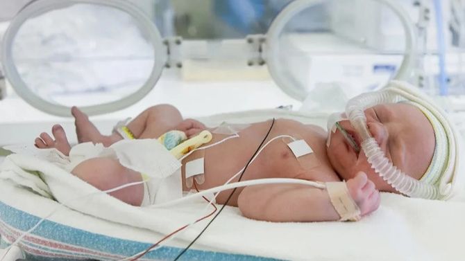 Последствия преждевременных родов