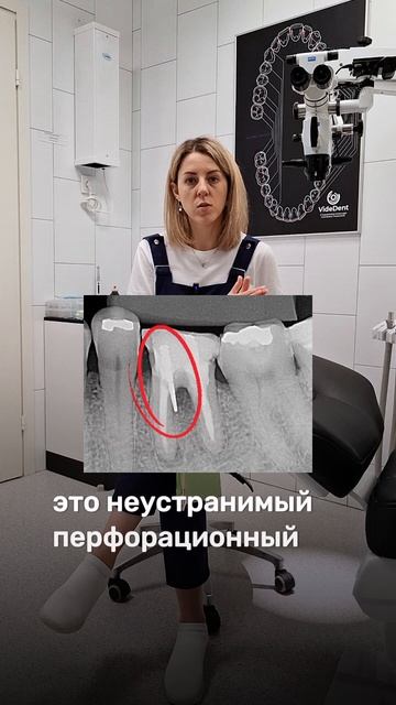 Когда зуб НЕЛЬЗЯ спасти? 4 ситуации #стоматология #удалениезуба #зубнаяболь #зуб #эндодонтия