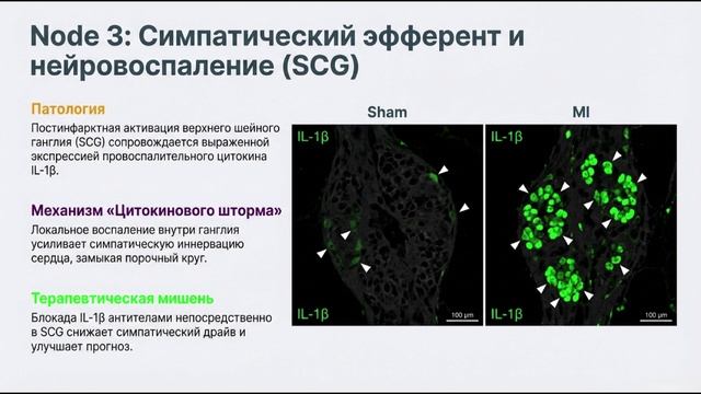 Как мозг добивает сердце после инфаркта