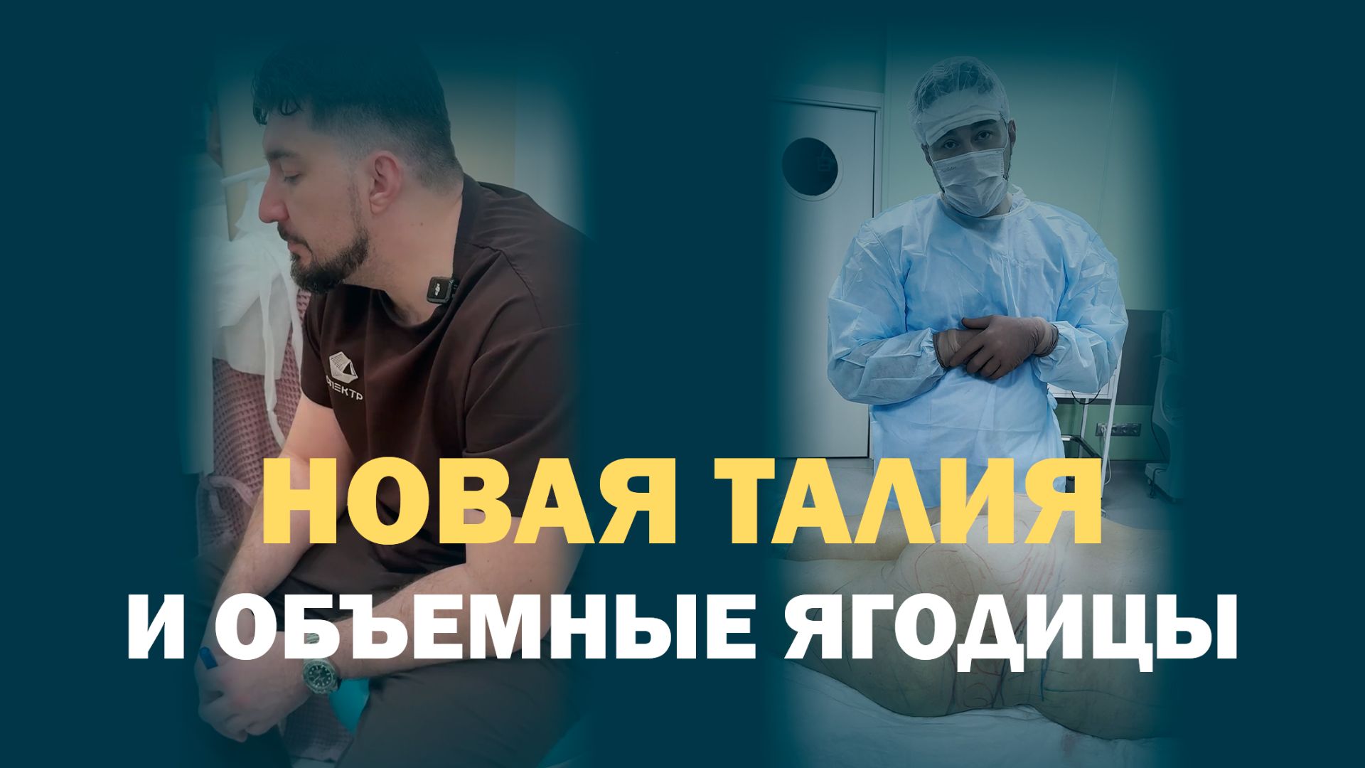 Липоскульптура тела: формирование талии и объема ягодиц