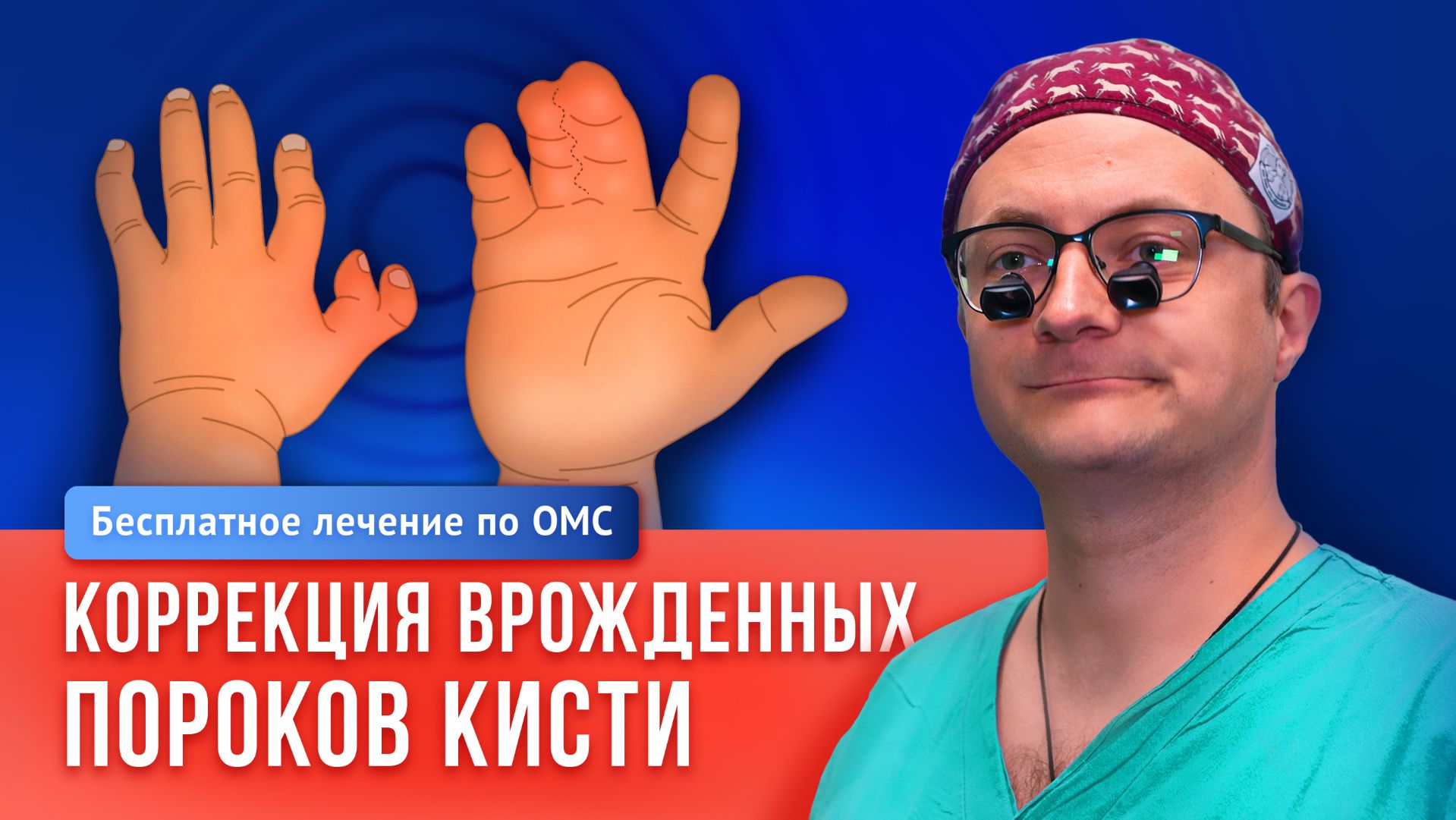 Почему дети рождаются с пороками кисти и как им помогают сегодня? Интервью с врачом ММКЦ Коммунарка