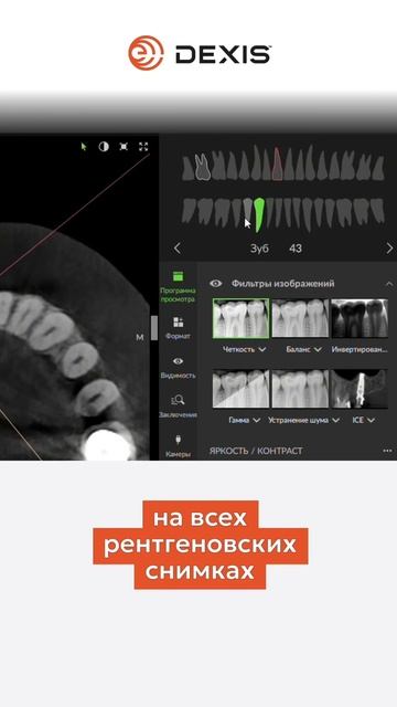 DTX Studio Clinic - ПО для улучшения диагностики и общения с пациентами.