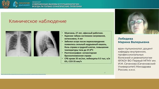 12.02.2026 Вебинар «Современные вызовы в пульмонологии – всегда ли только соматические проблемы»
