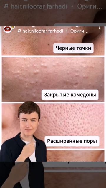 Лекарства для красоты