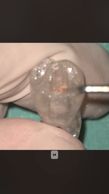 RT-Scraper EUROFILE - инструмент для удаления остатков гуттаперчи в корневом канале.