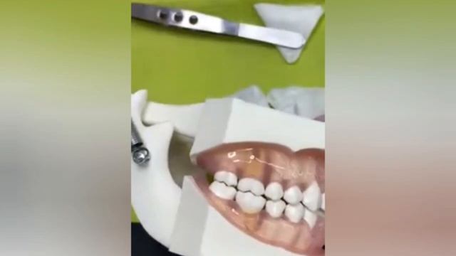 М-Чип пластинки - форма круг. Видеоинструкция.