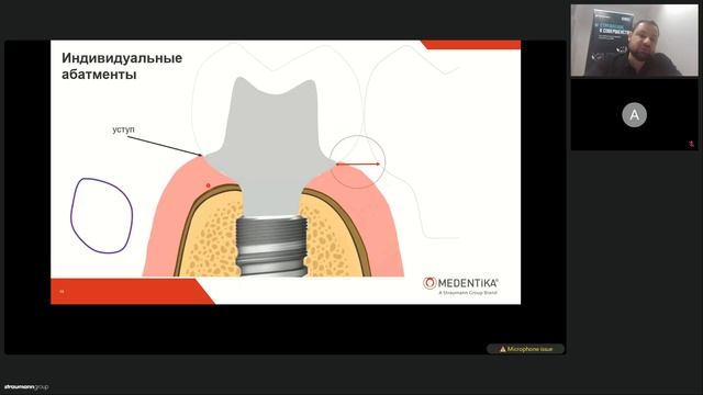 Вебинар: MEDENTiKA как ключ к взаимопониманию между врачом и зубным техником