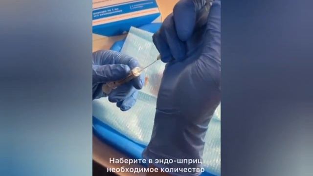 Применение клея Сульфакрилат