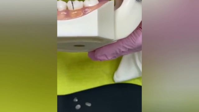 М-Чип пластинки - форма треугольник. Видеоинструкция.